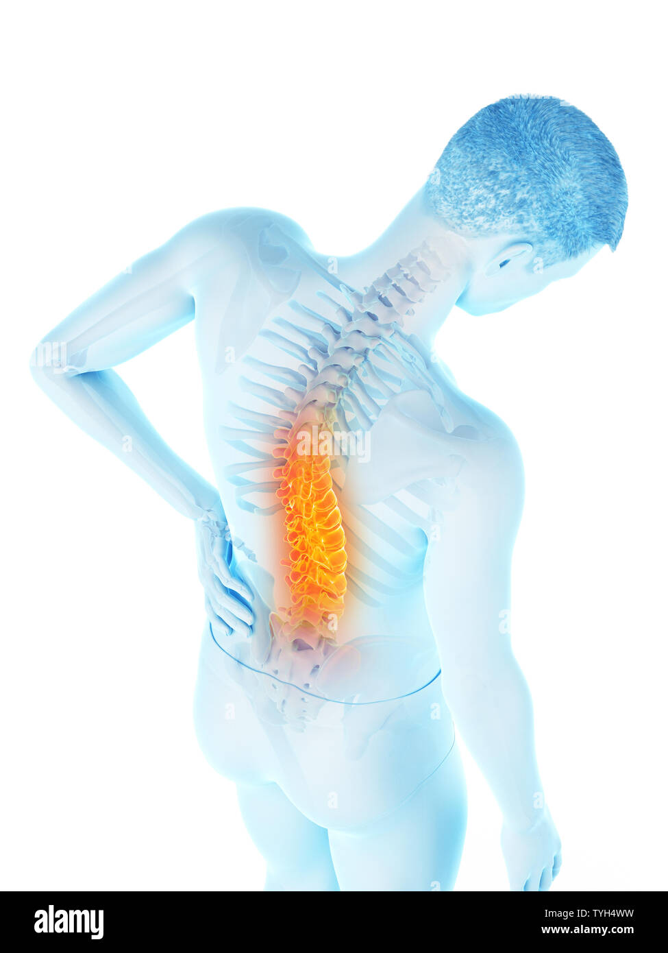 3d rendered medically accurate illustration of a man having backache ...