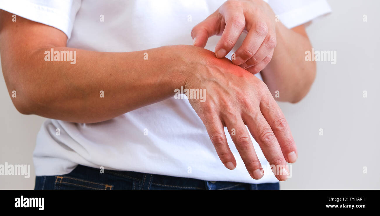 Woman Scratching an itch . Sensitive Skin, Food allergy symptoms ...