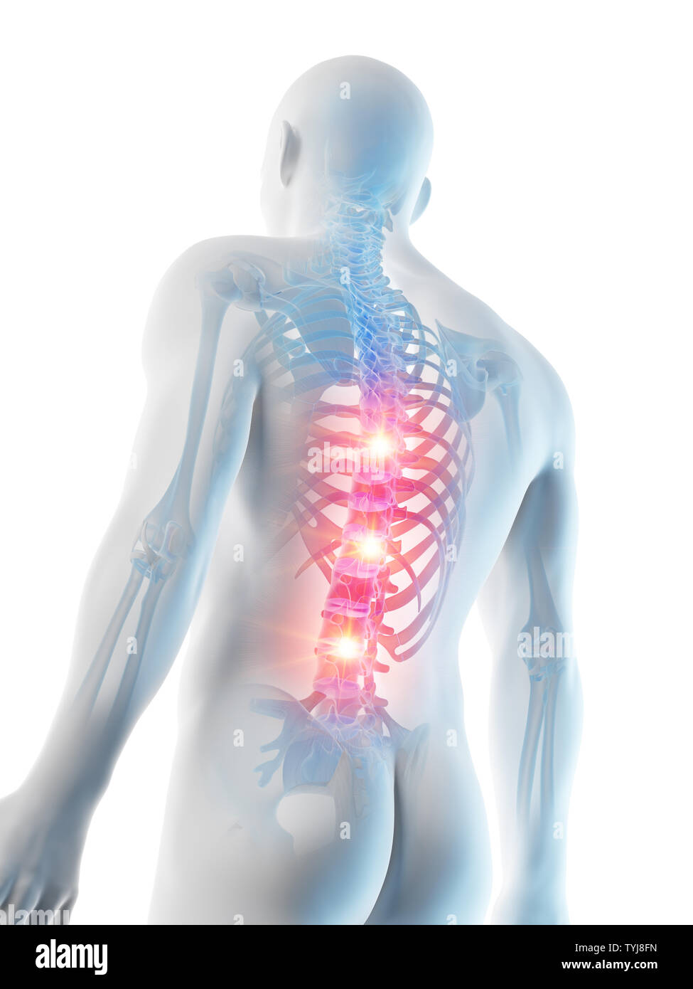 3d rendered illustration of a mans painful back Stock Photo - Alamy