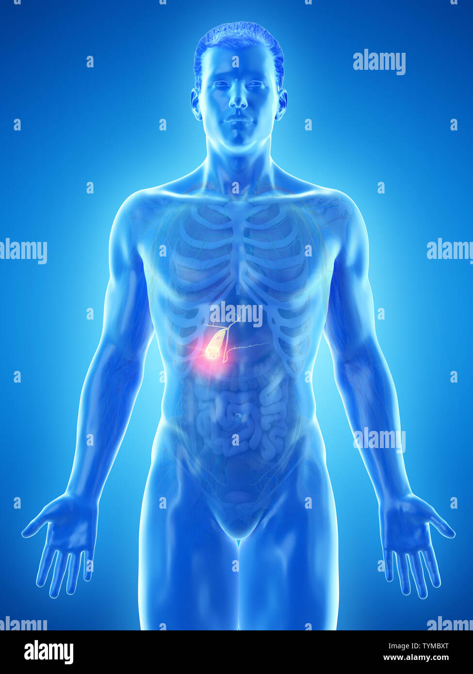 3d rendered medically accurate illustration of a mans gallbladder tumor ...