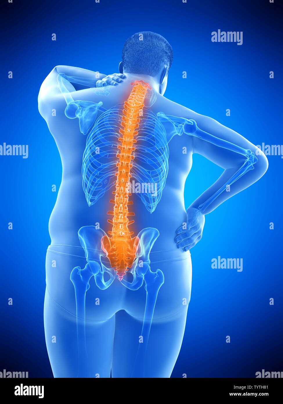 Obese mans painful back hi-res stock photography and images - Alamy