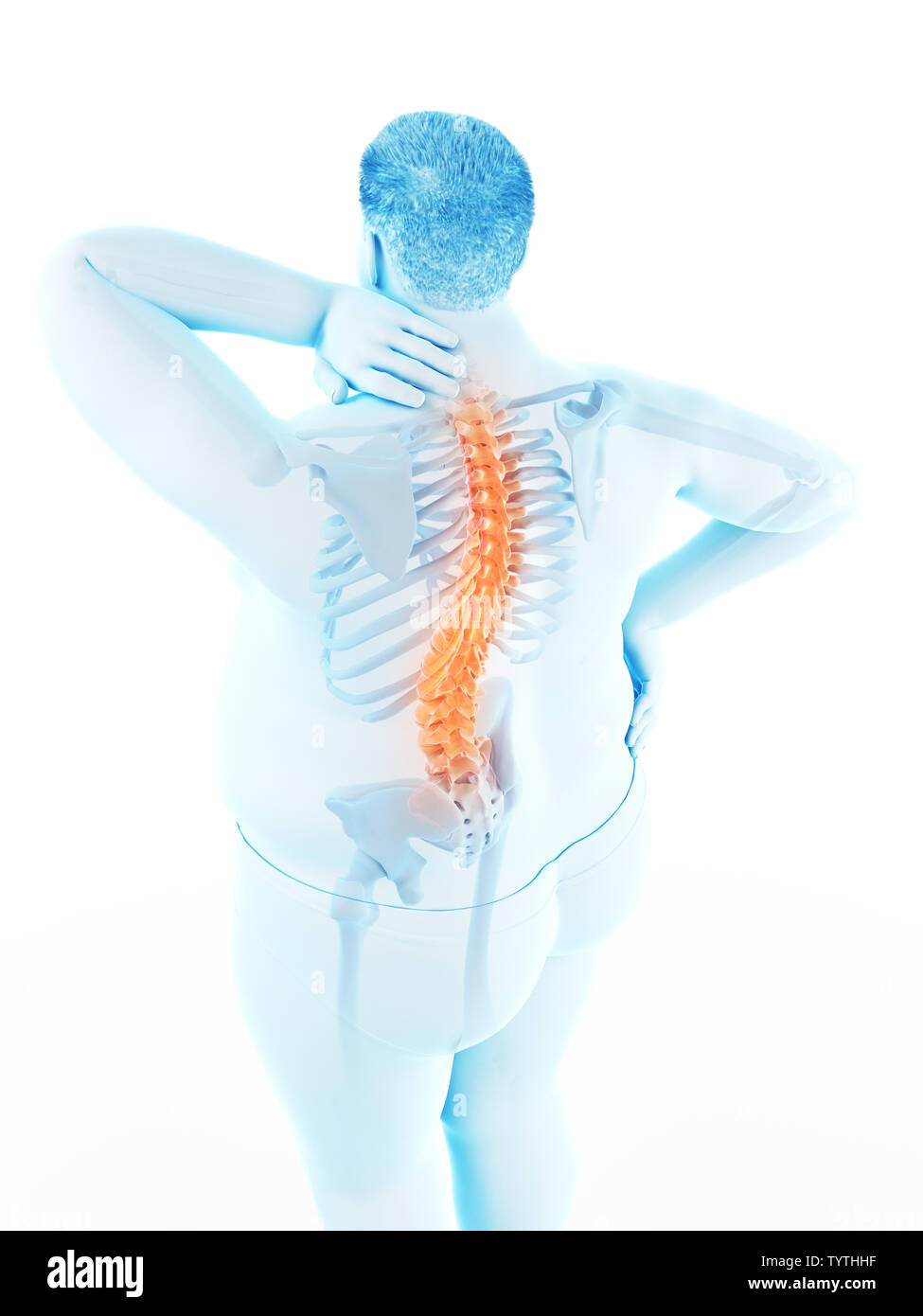 Obese mans painful back hi-res stock photography and images - Alamy