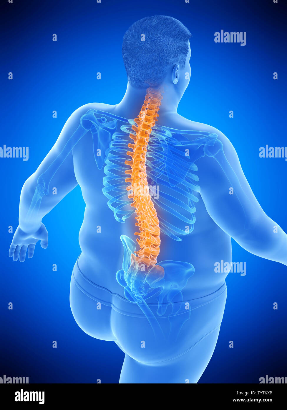 Obese mans painful back hi-res stock photography and images - Alamy