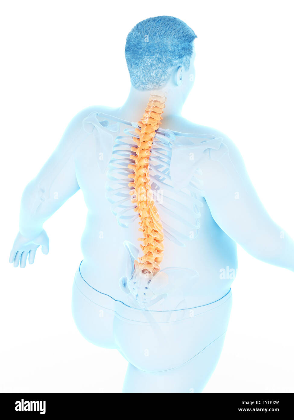 3d rendered medically accurate illustration of an obese mans painful ...