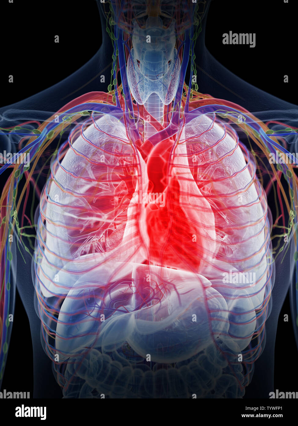 3d rendered medically accurate illustration of an inflamed heart Stock ...