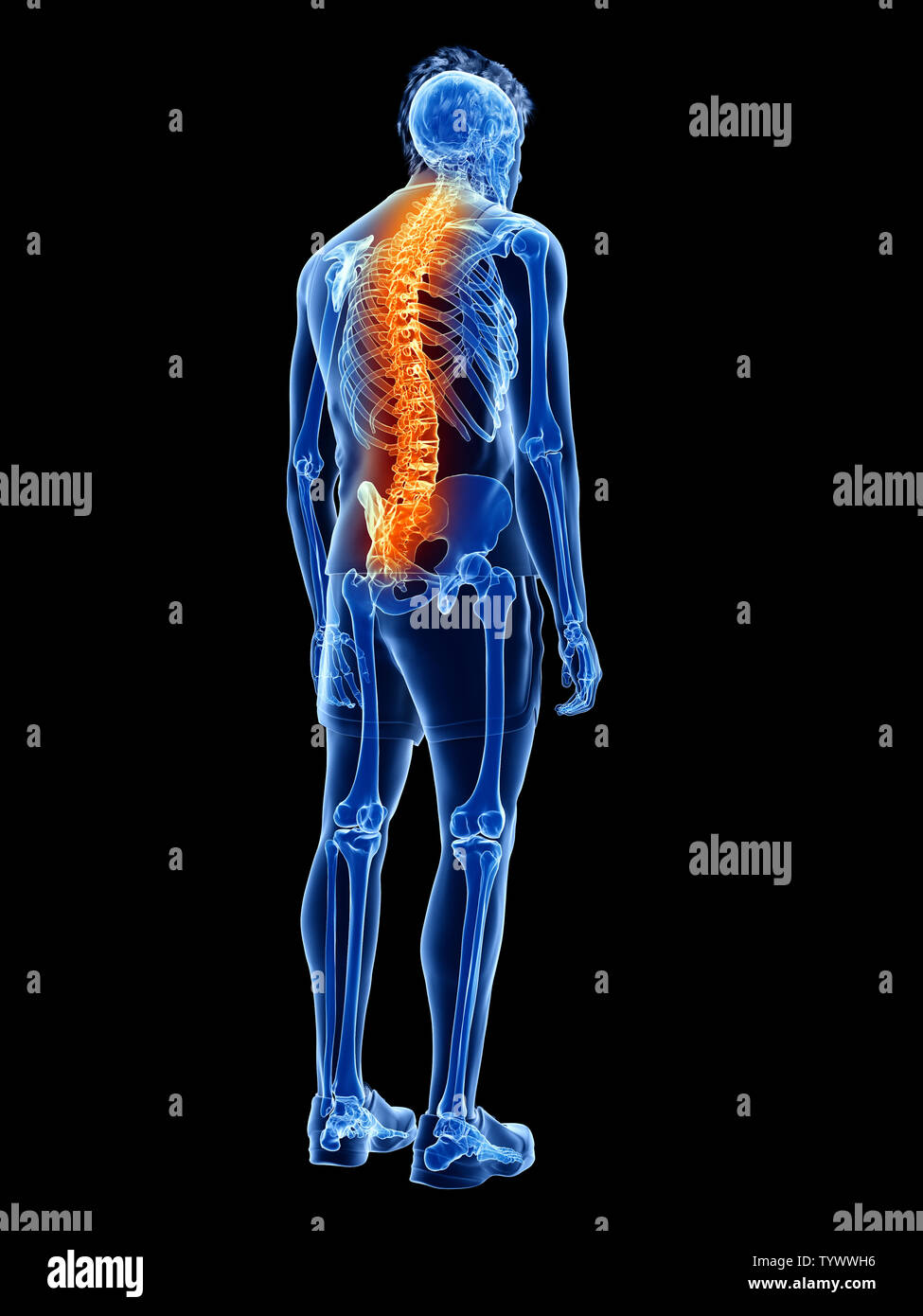 3d rendered medically accurate illustration of a man having back pain ...