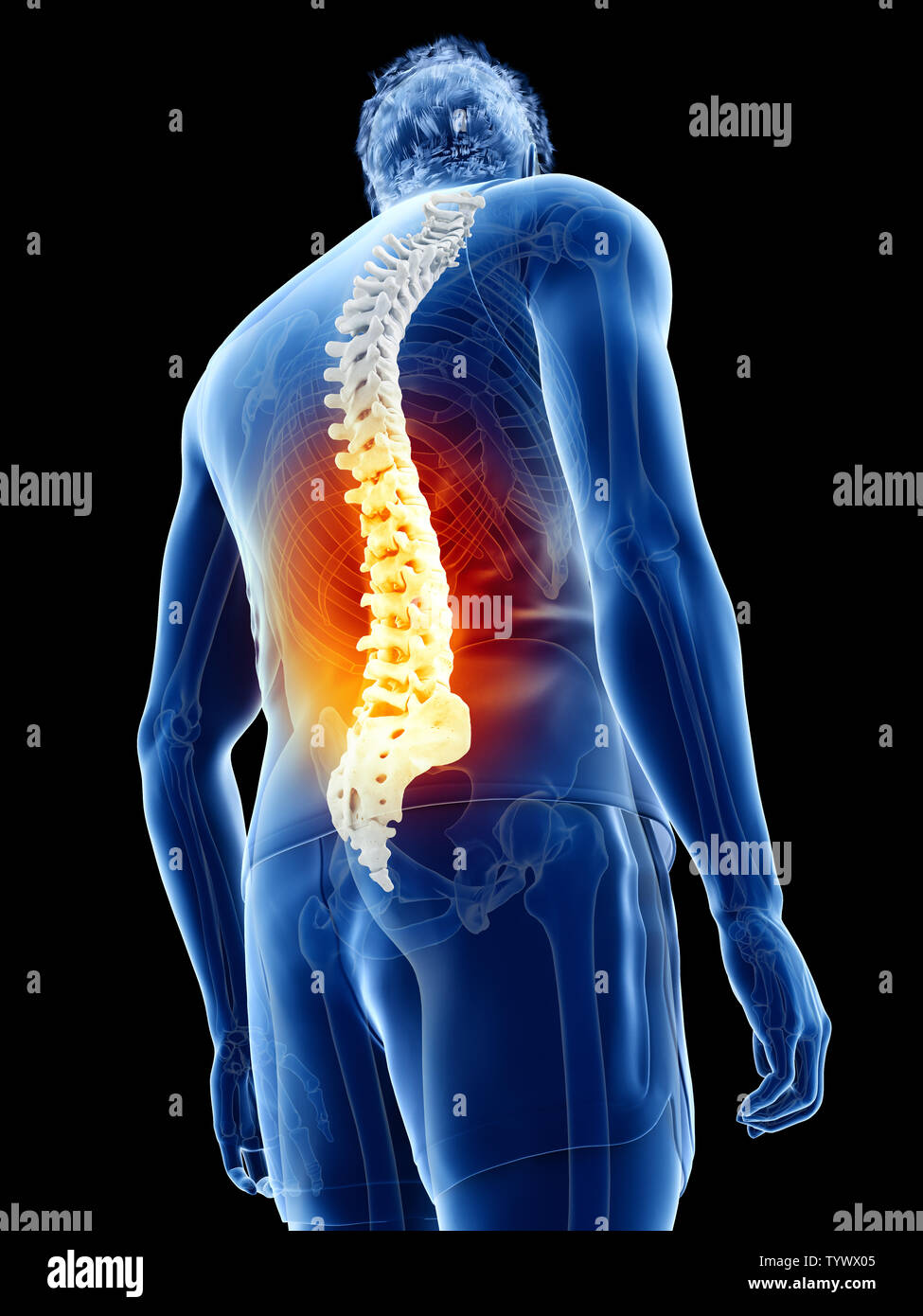 3d rendered medically accurate illustration of a man having back pain ...