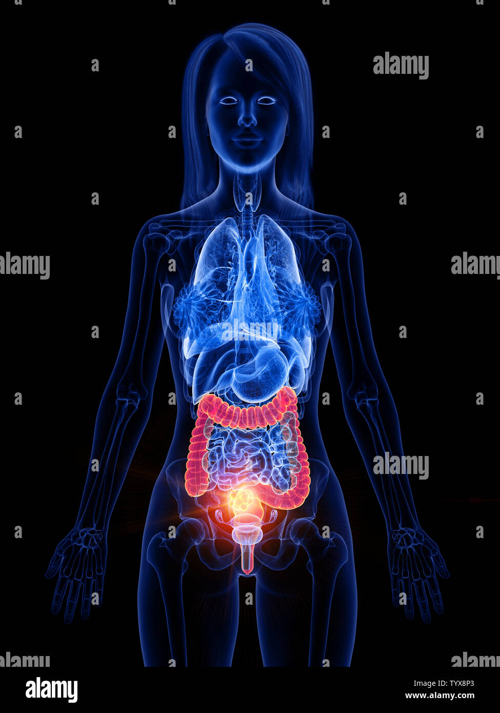 3d rendered medically accurate illustration of a womans large intestine ...