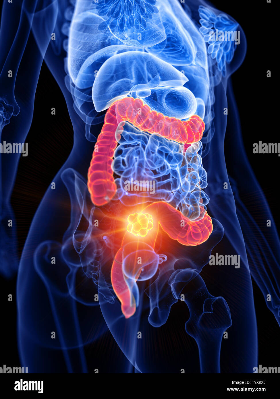 3d rendered medically accurate illustration of a womans large intestine ...