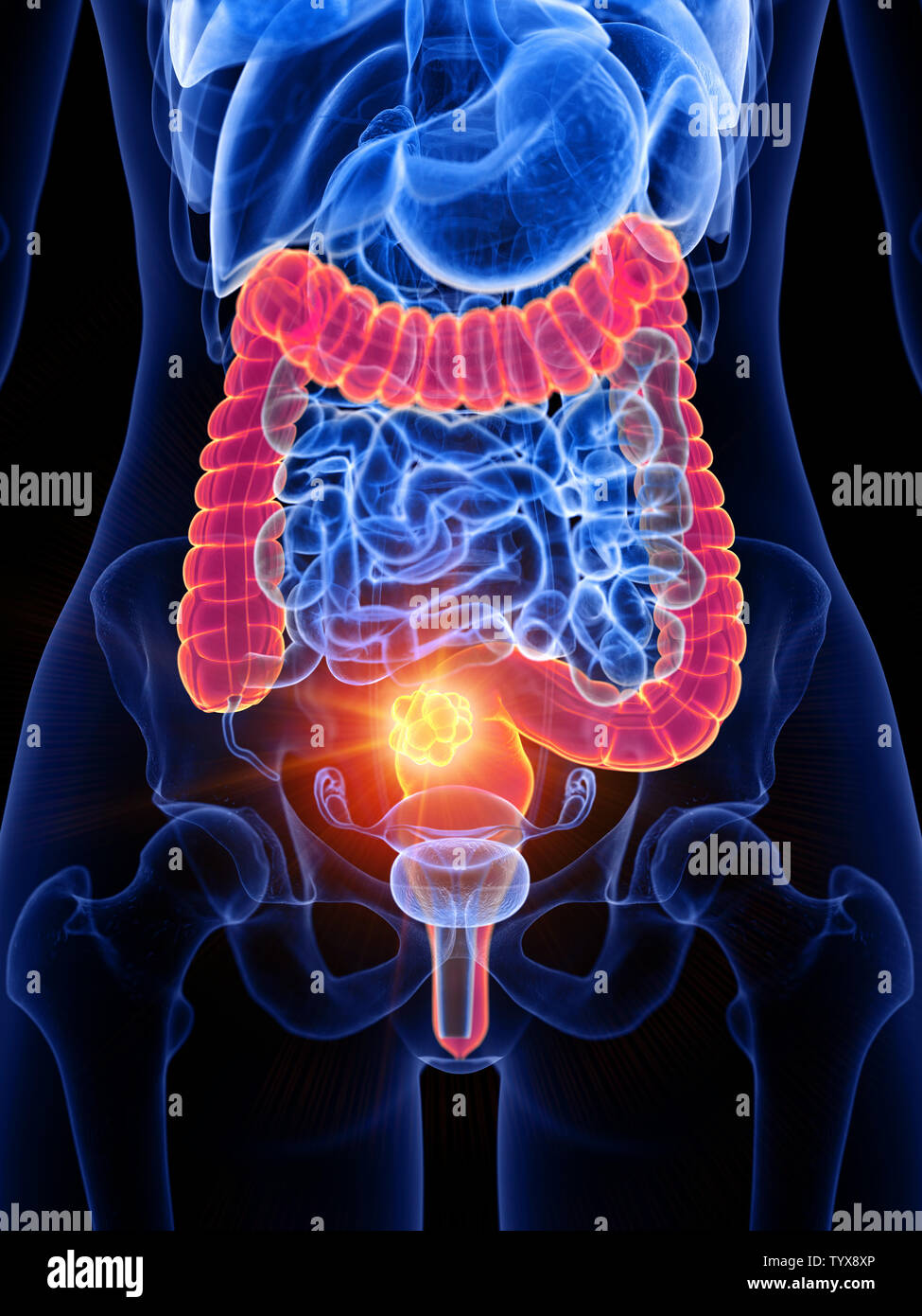 3d rendered medically accurate illustration of a womans large intestine ...