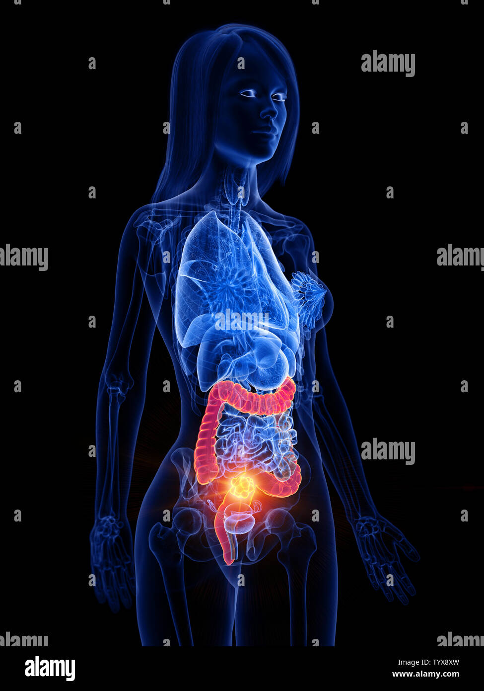 3d rendered medically accurate illustration of a womans large intestine ...
