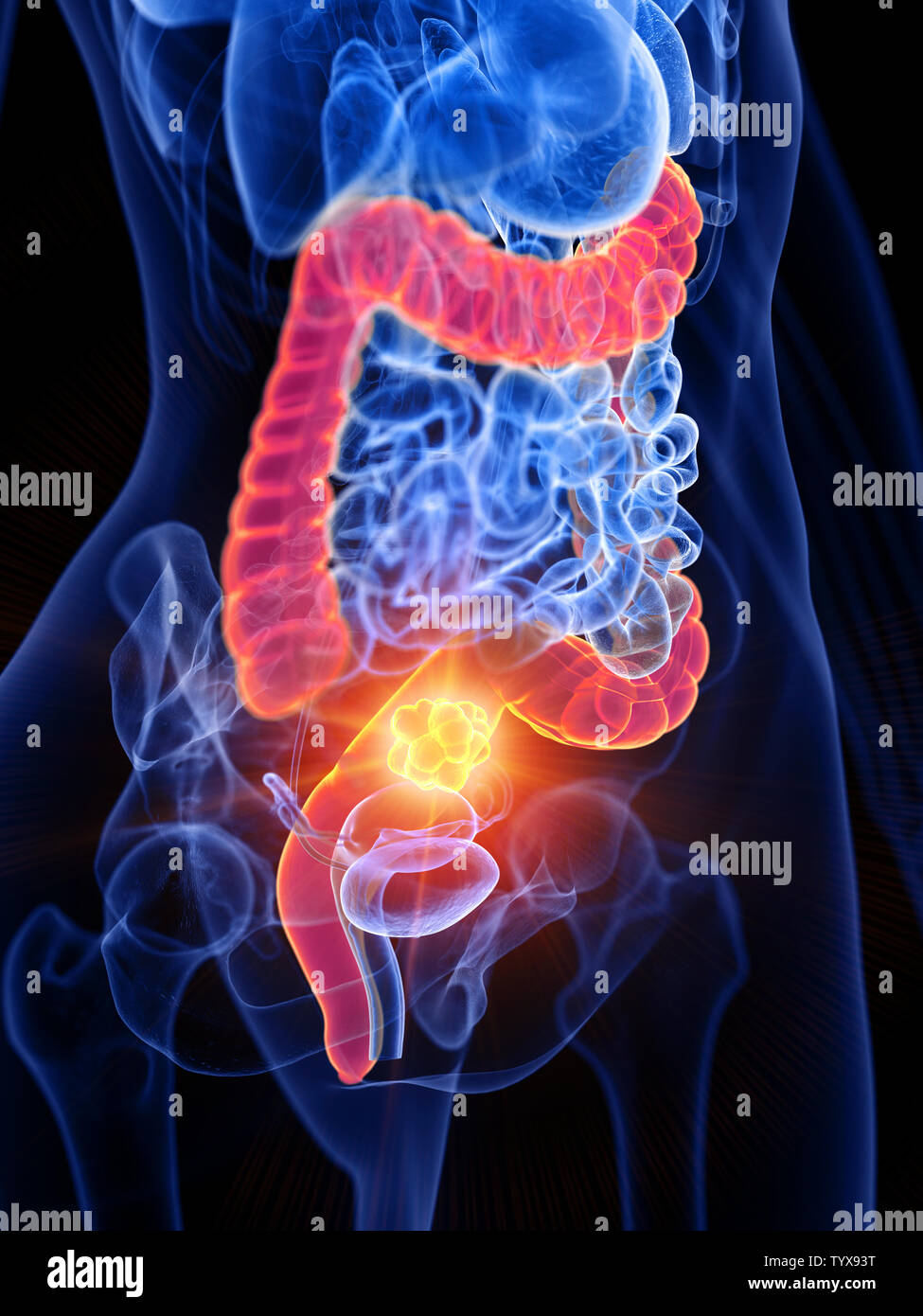3d rendered medically accurate illustration of a womans large intestine ...
