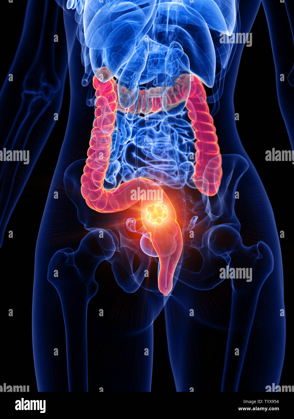 3d rendered medically accurate illustration of a womans large intestine ...