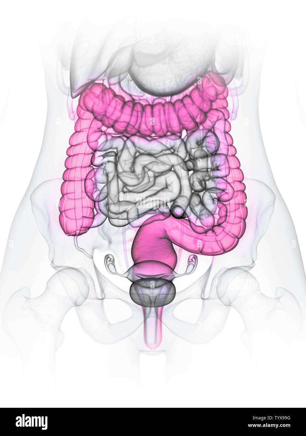 Large intestine diverticulitis Cut Out Stock Images & Pictures - Alamy