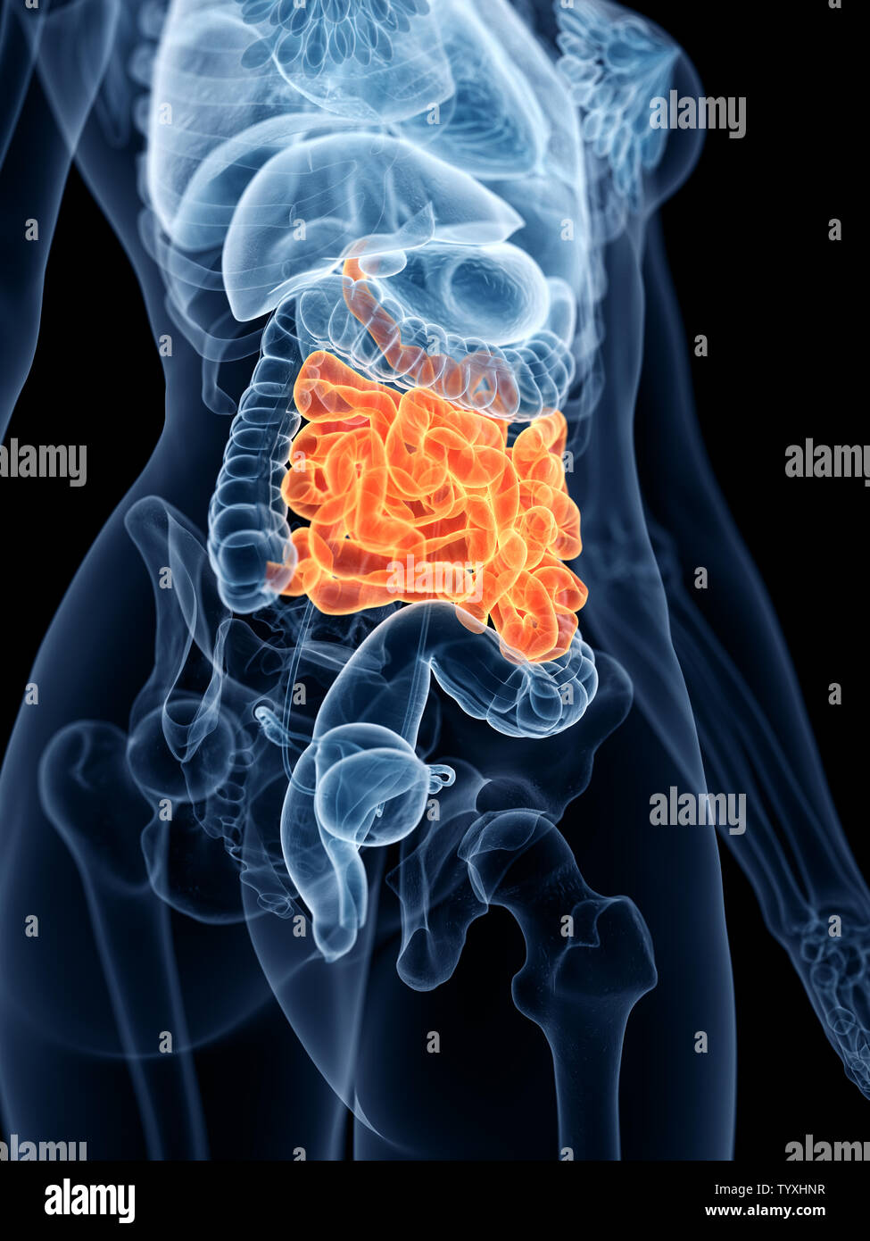 Small bowel obstruction hi-res stock photography and images - Alamy