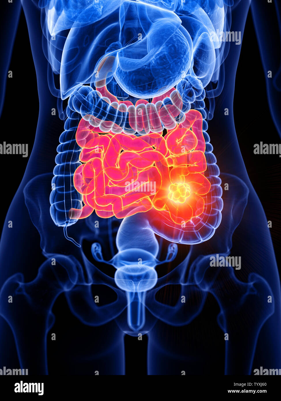 3d rendered medically accurate illustration of a womans small intestine ...