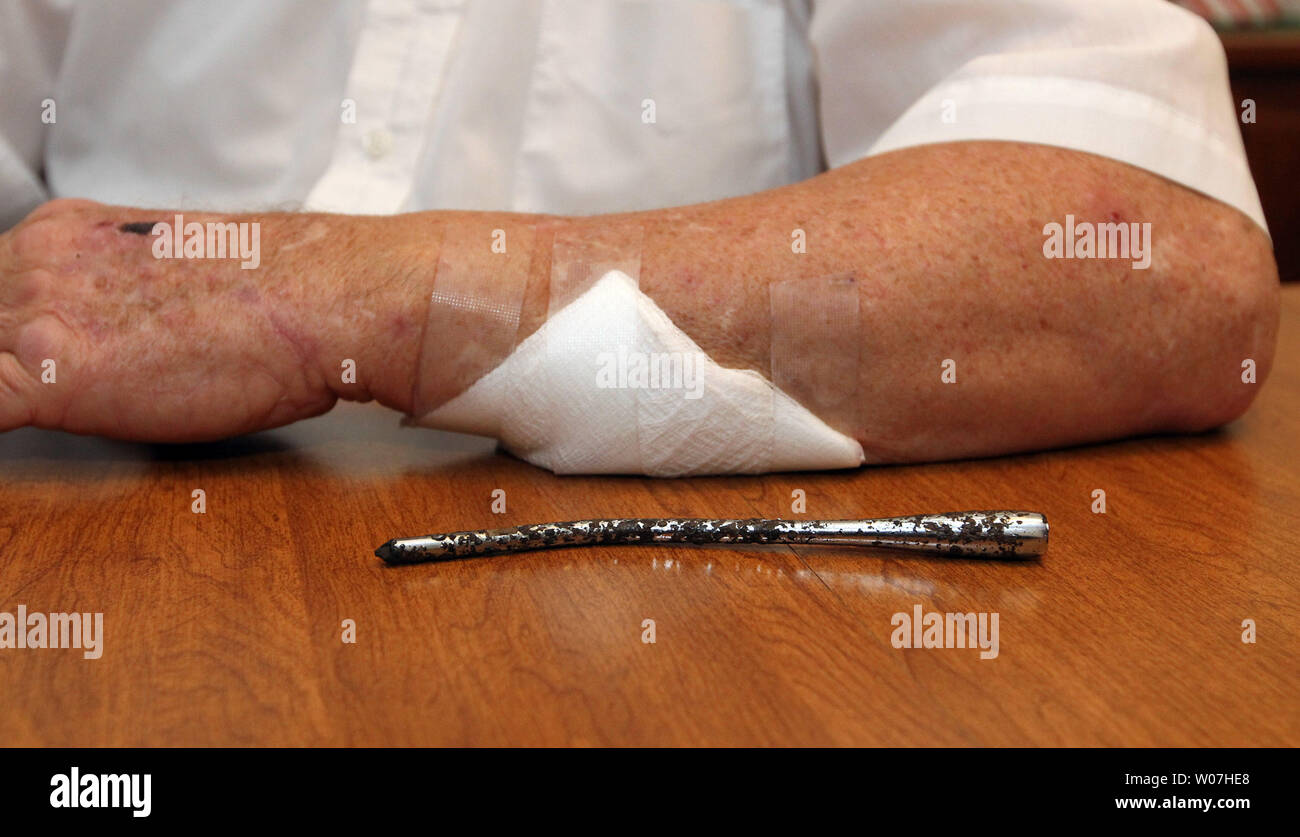 Broken glass blood hi-res stock photography and images - Alamy