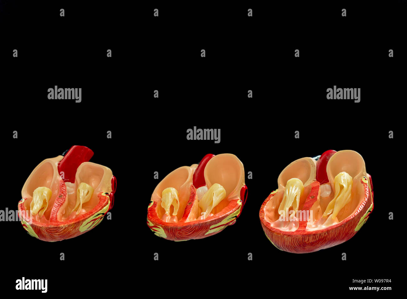 dog hearts mold, normal heart and heart with DCM, isolated on black ...