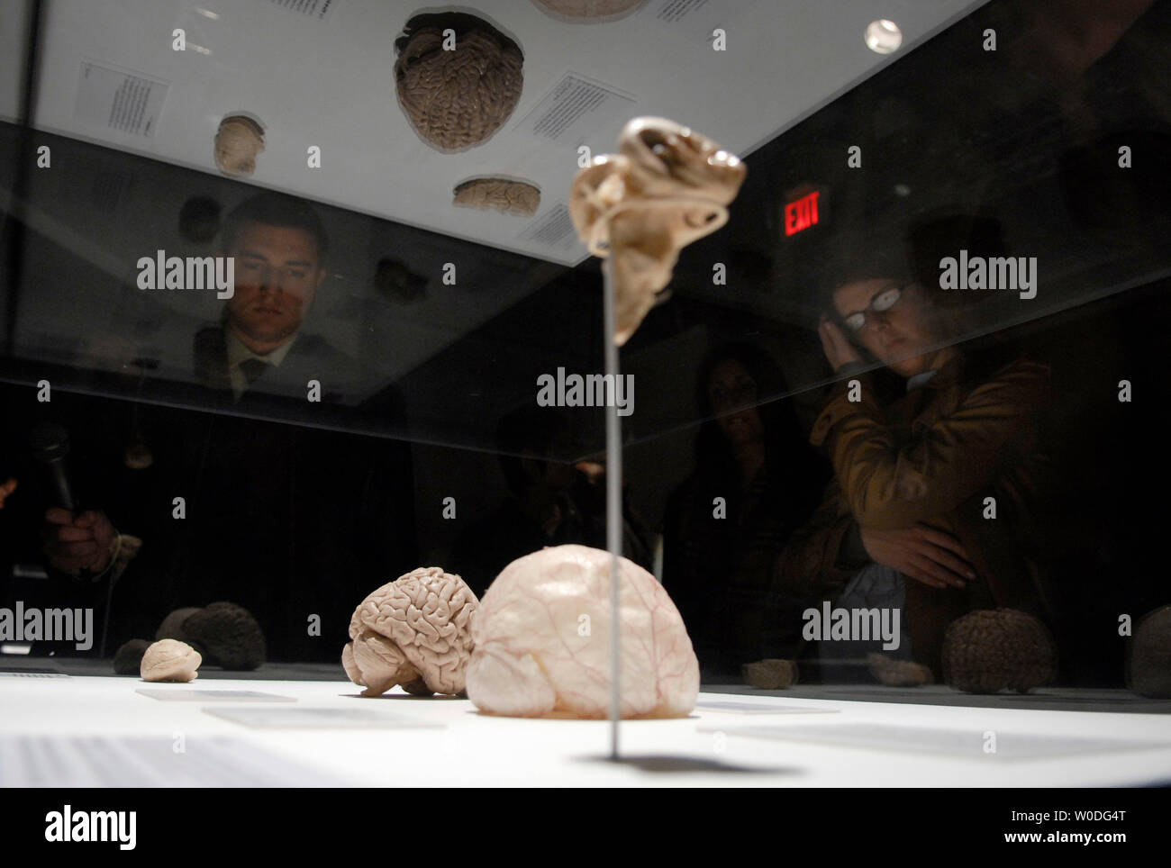 Real brain human hi-res stock photography and images - Alamy