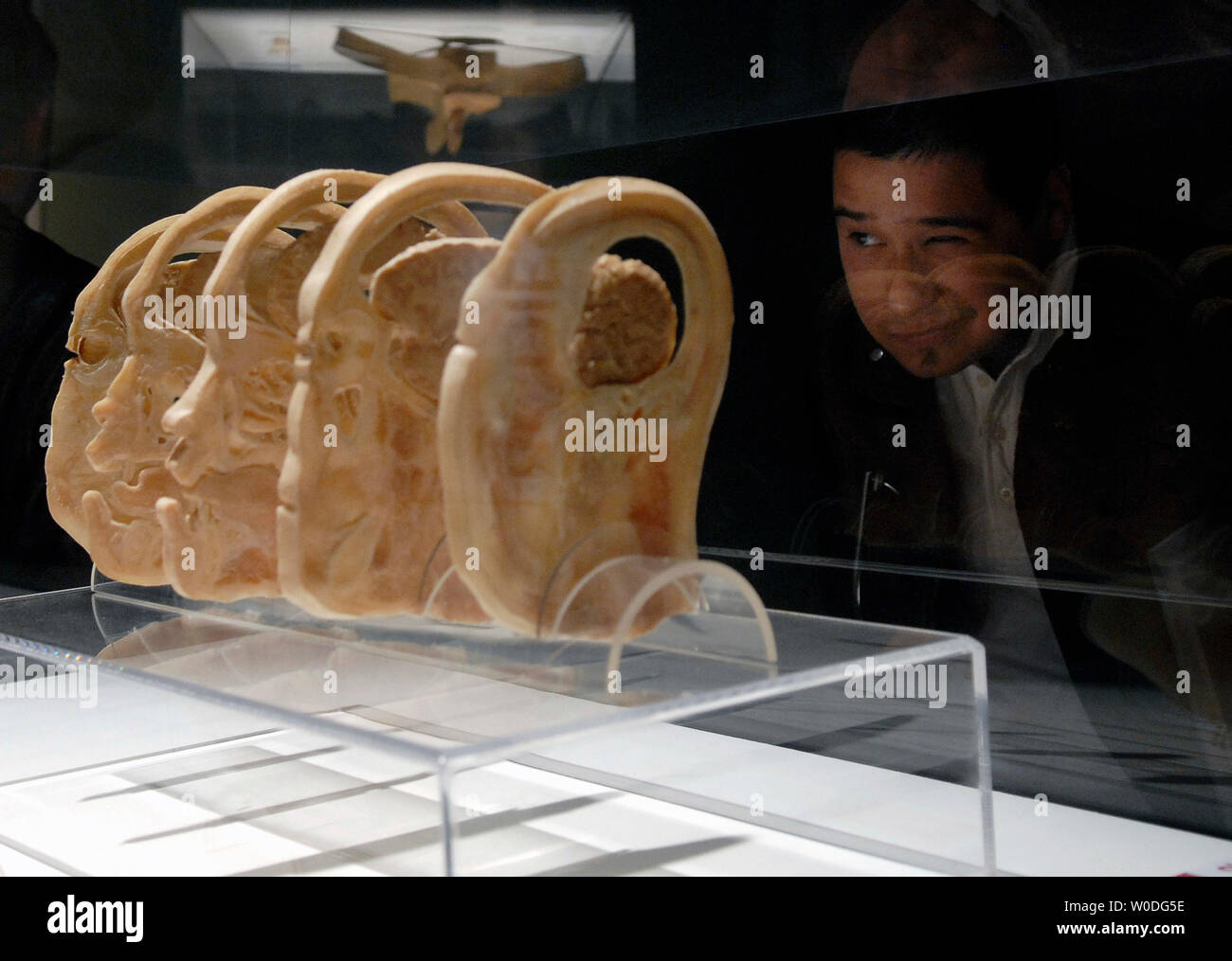 Dissected human bodies hi-res stock photography and images - Alamy