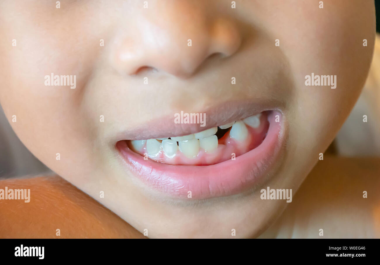 Baby teeth are just dropped in the mouth Stock Photo - Alamy