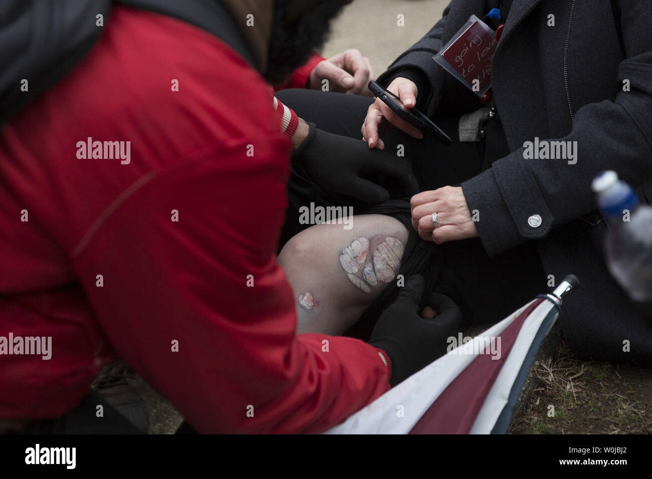 A medic cares for a woman's leg that was hit by shrapnel from a tear ...