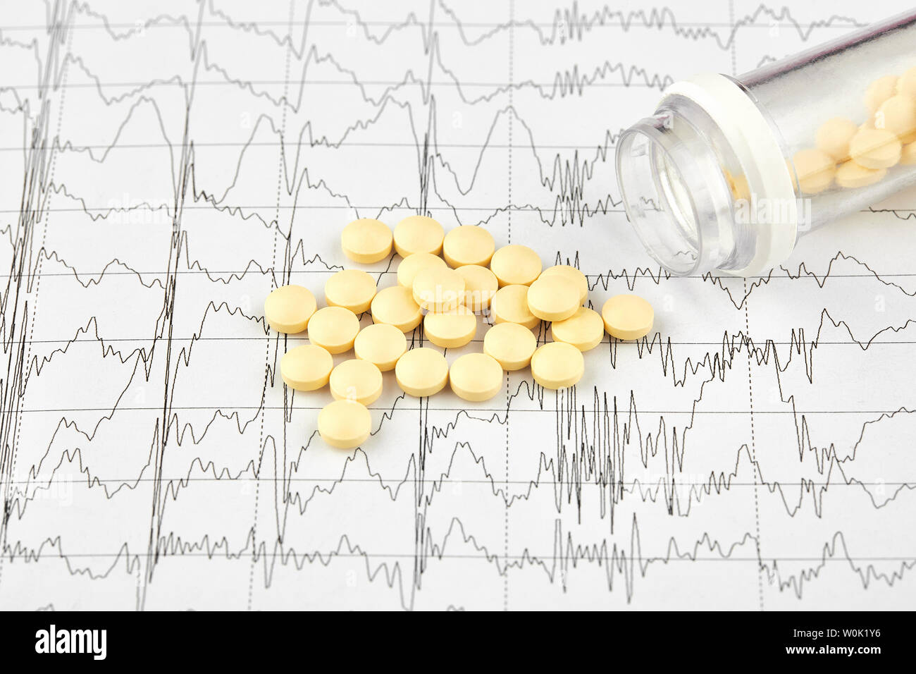 Close-up photo of yellow pills and vial on EKG graph Stock Photo - Alamy