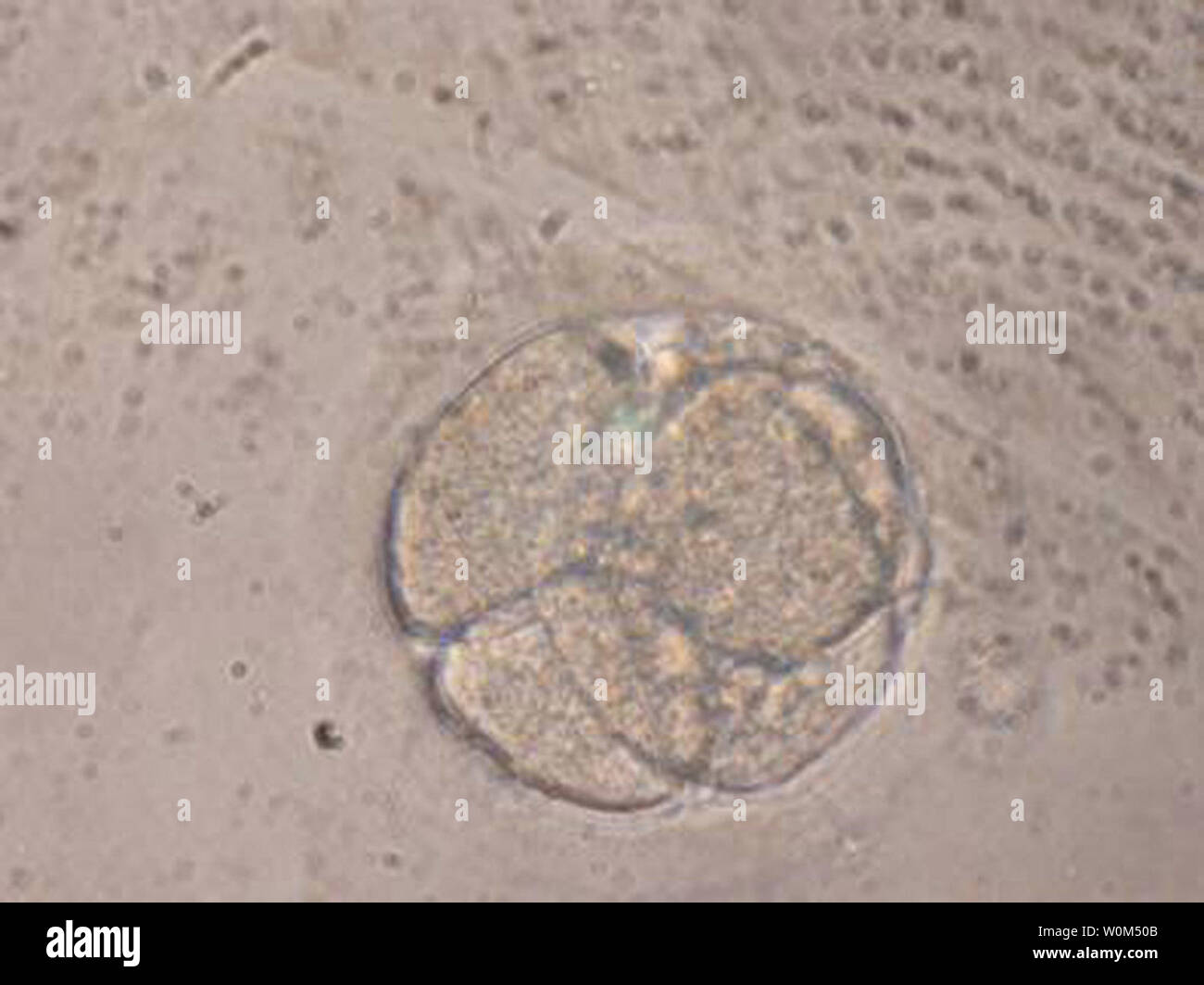 A microscopic photo of a cloned human embryo at the four cell stage ...