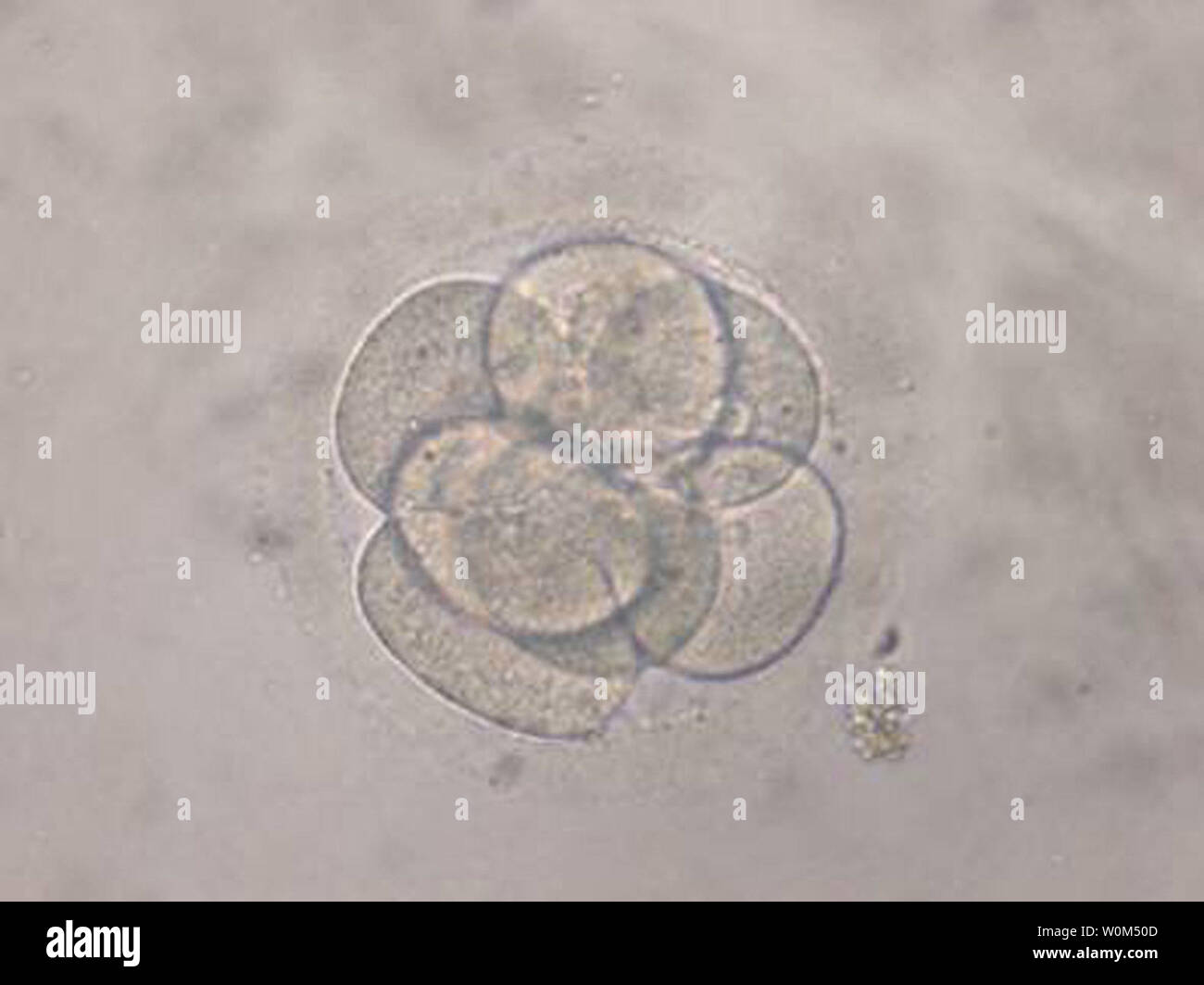 A microscopic photo of a cloned human embryo at the eight cell stage ...