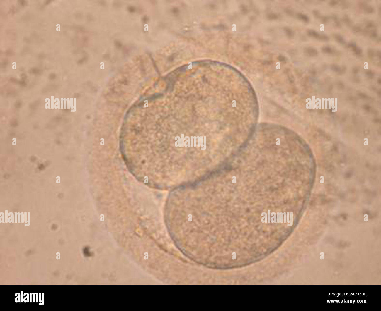 A microscopic photo of a cloned human embryo at the four cell stage ...