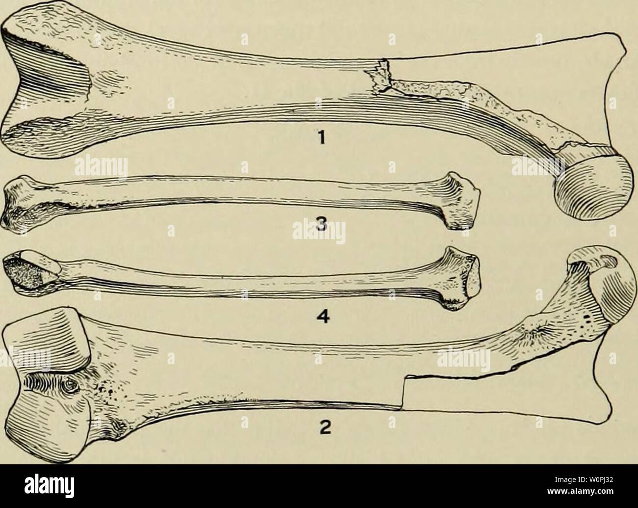 Distal tibia bone hi-res stock photography and images - Alamy
