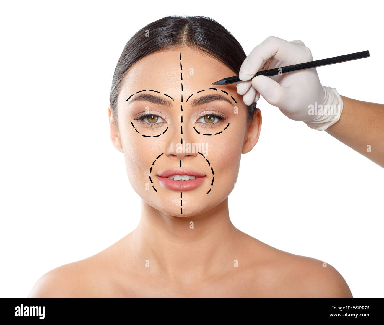 woman with dotted lines on face, cosmetology Stock Photo - Alamy
