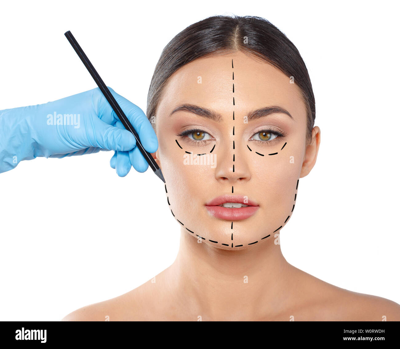 woman with dotted lines on face, cosmetology Stock Photo - Alamy