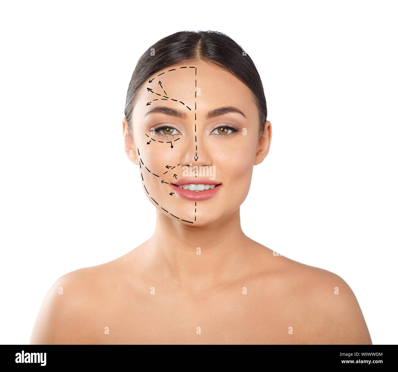 woman with dotted lines on face, cosmetology Stock Photo - Alamy