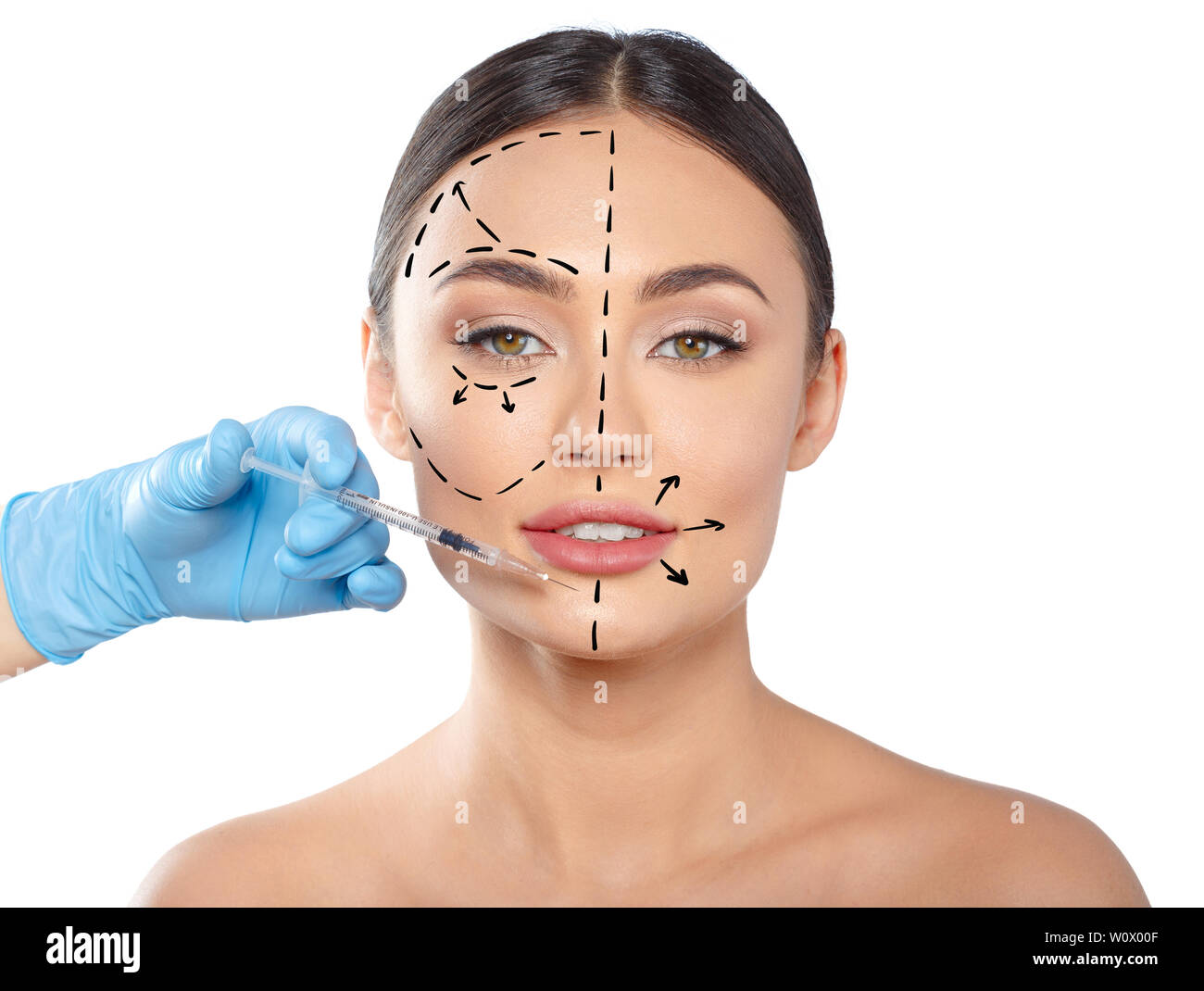 woman with dotted lines on face, cosmetology Stock Photo - Alamy