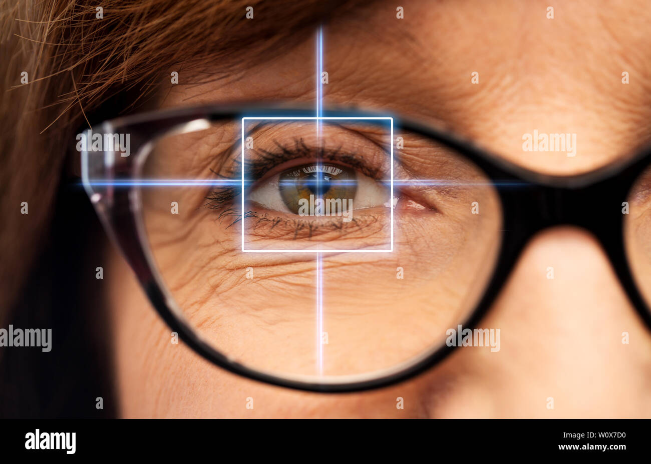 Eye surgery woman laser hi-res stock photography and images - Alamy