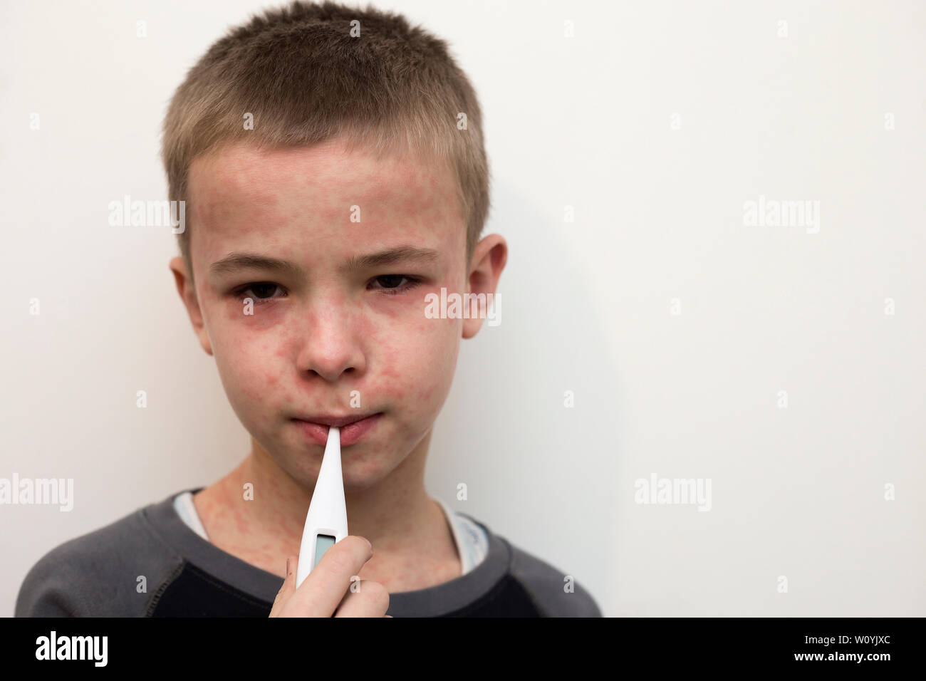 Portrait of sick sad boy child with thermometer having fever suffering ...