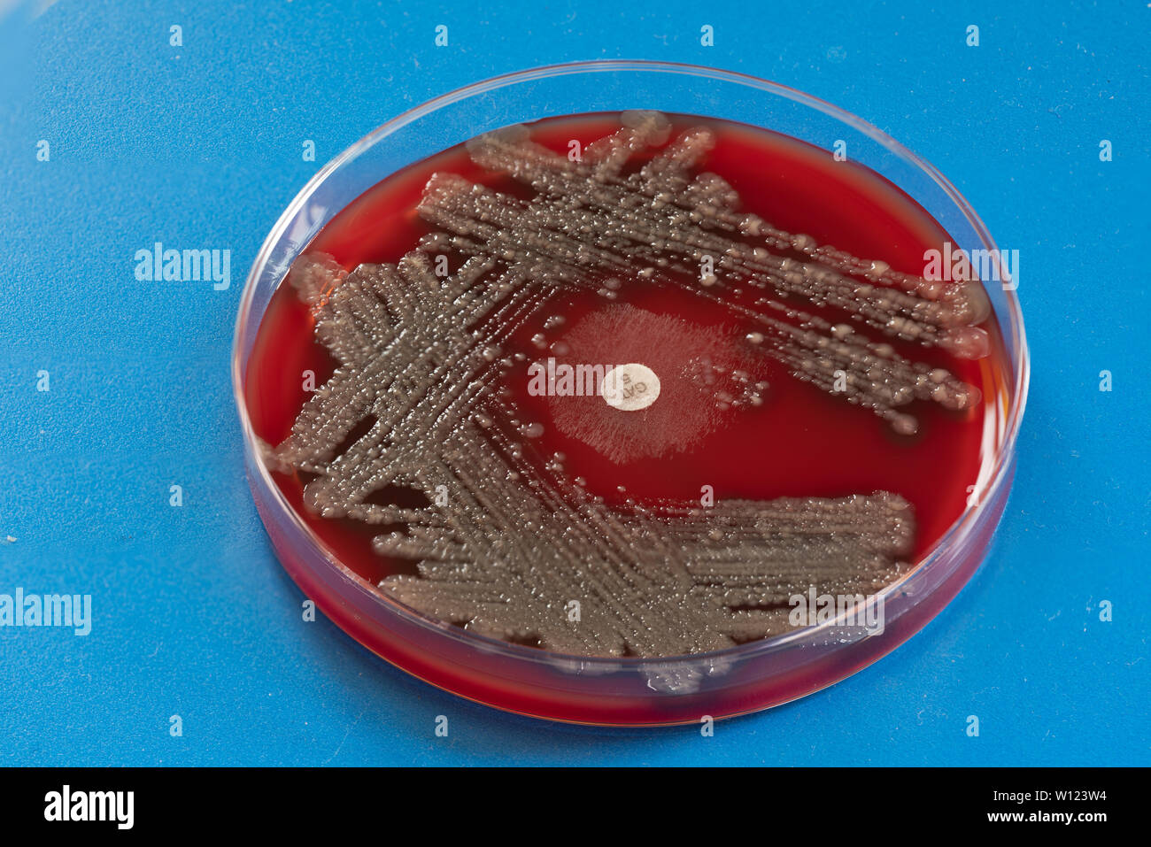 Sowing human feces in a petri dish Stock Photo - Alamy