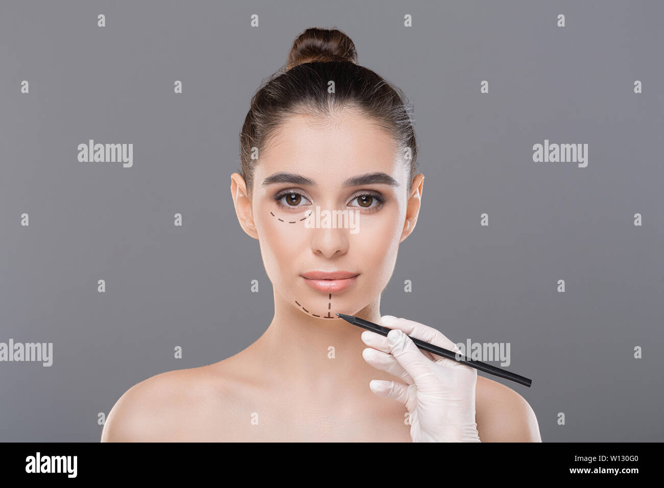 Doctor drawing lines on female patient's face before skin lifting Stock ...