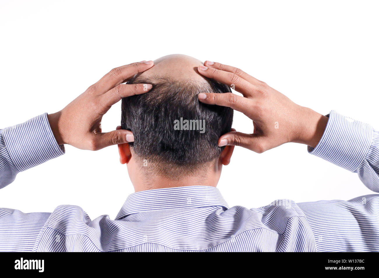 bald businessman with his head on scalp view from behind with white ...