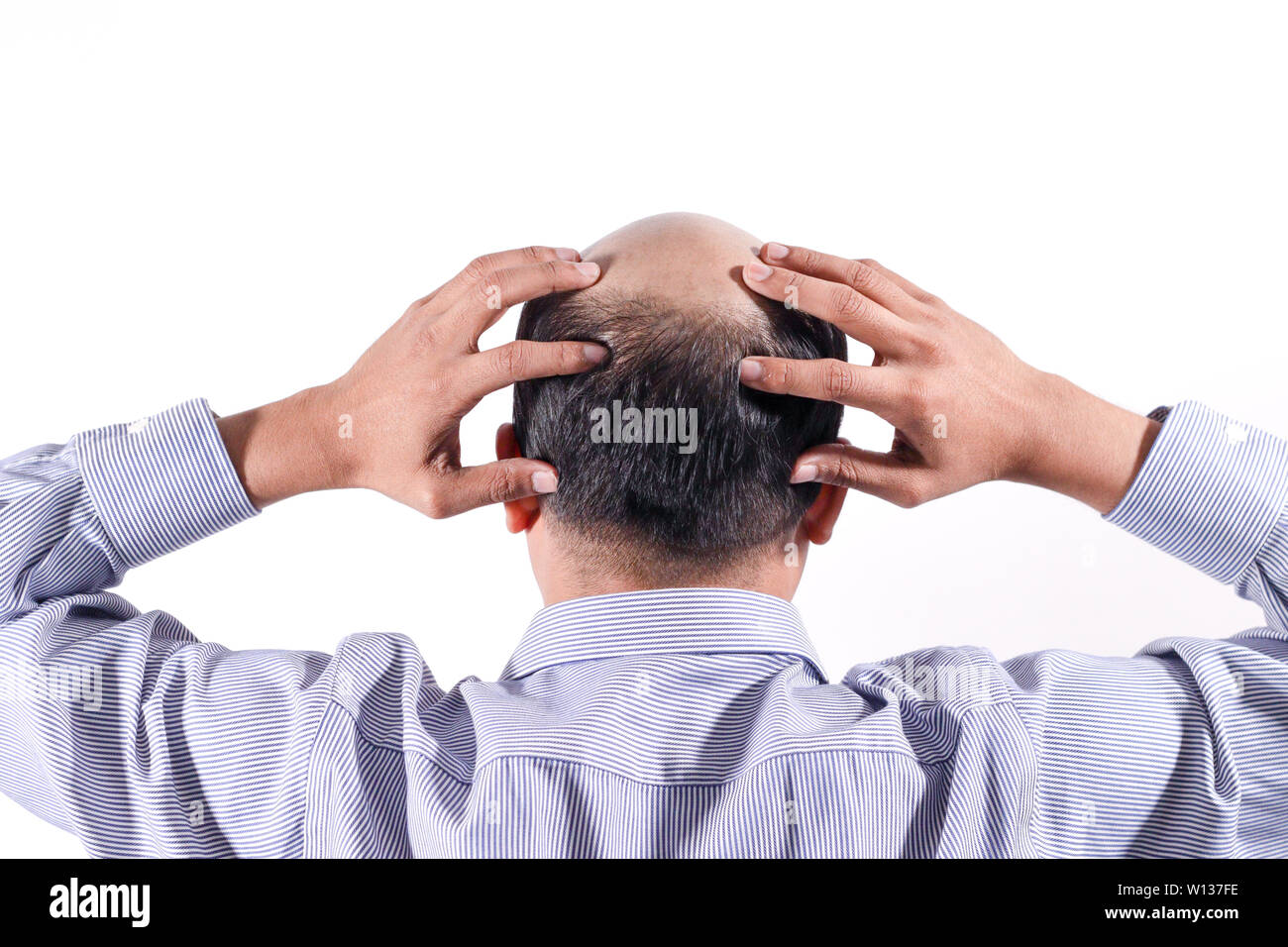 bald businessman with his head on scalp view from behind with white ...