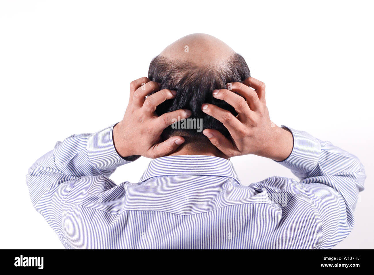 bald businessman with his head on scalp view from behind with white ...