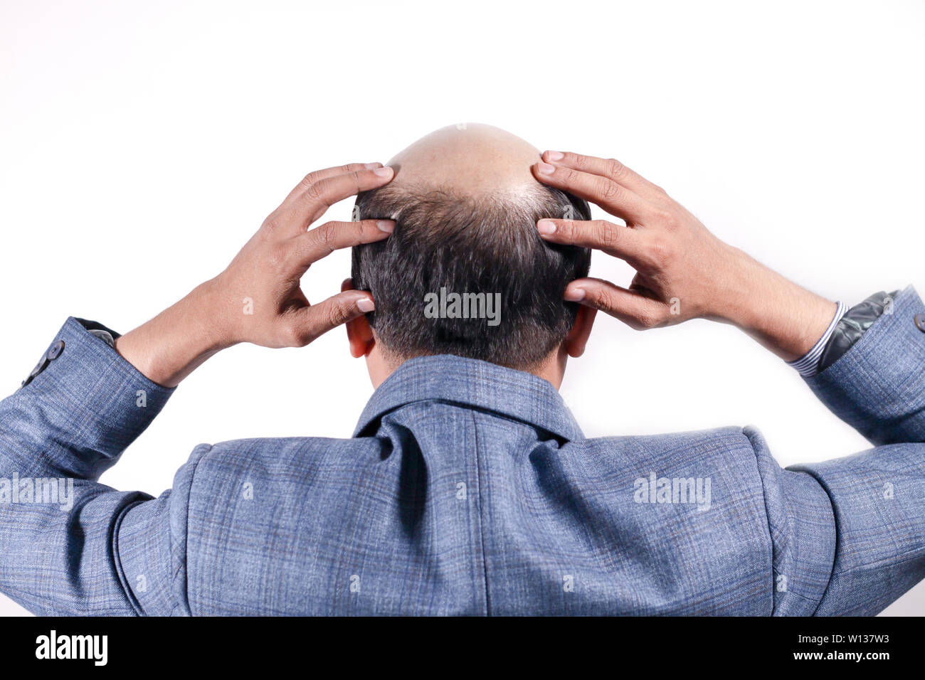 bald businessman with his head on scalp view from behind with white ...