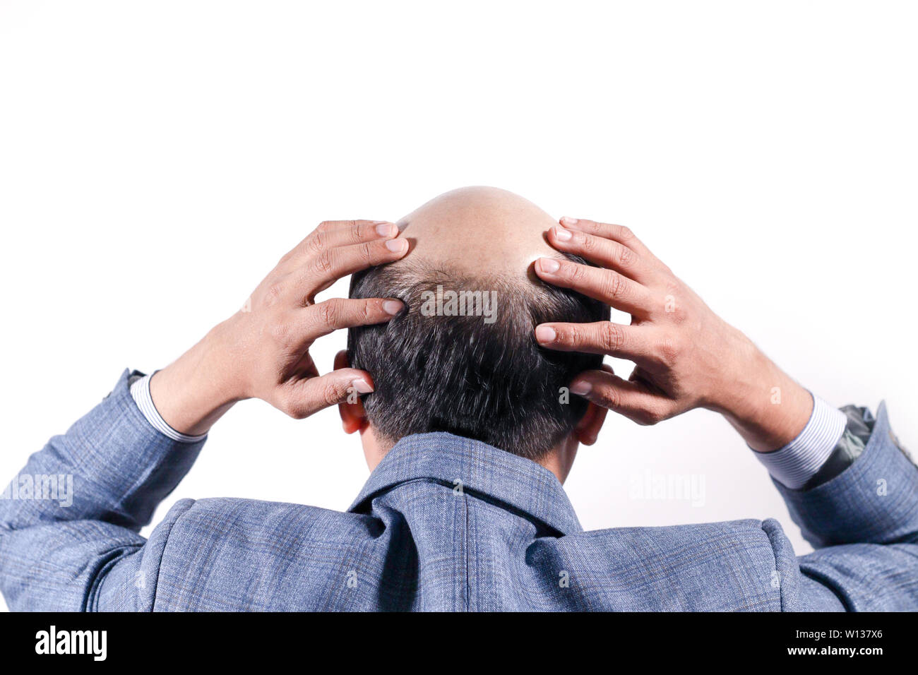 bald businessman with his head on scalp view from behind with white ...
