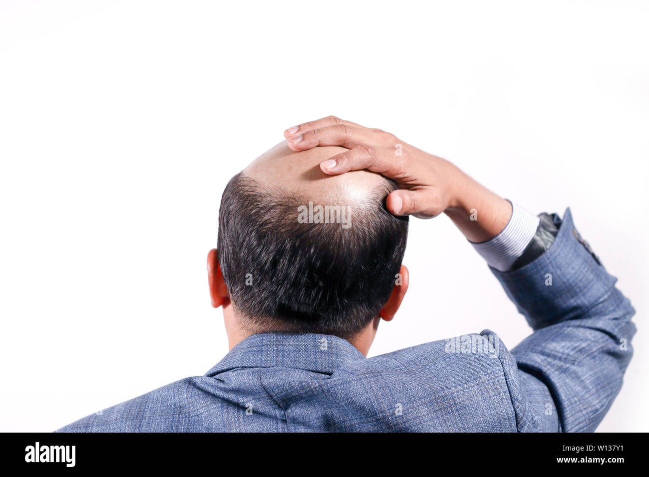 bald businessman with his head on scalp view from behind with white ...