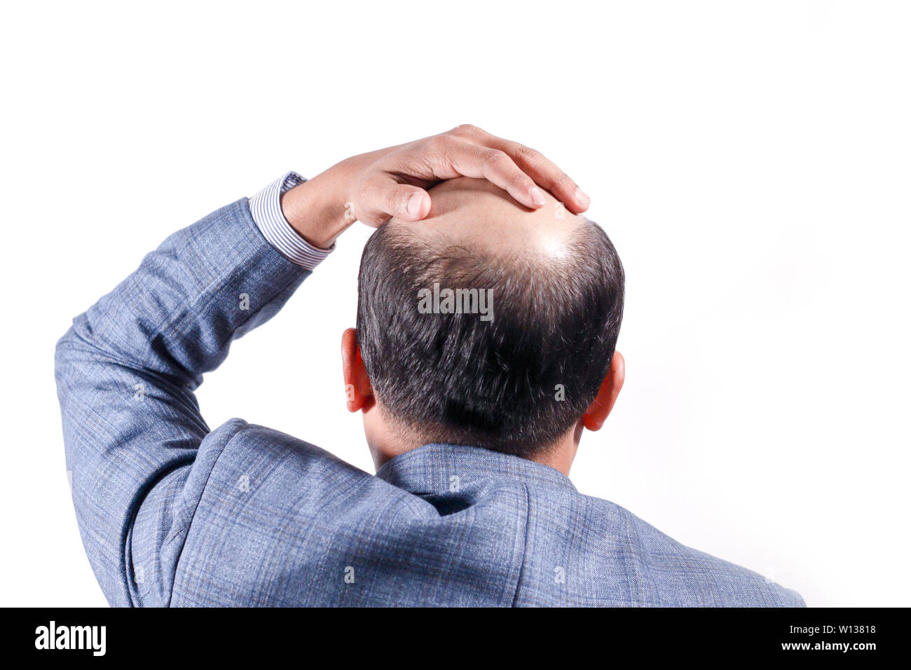 bald businessman with his head on scalp view from behind with white ...