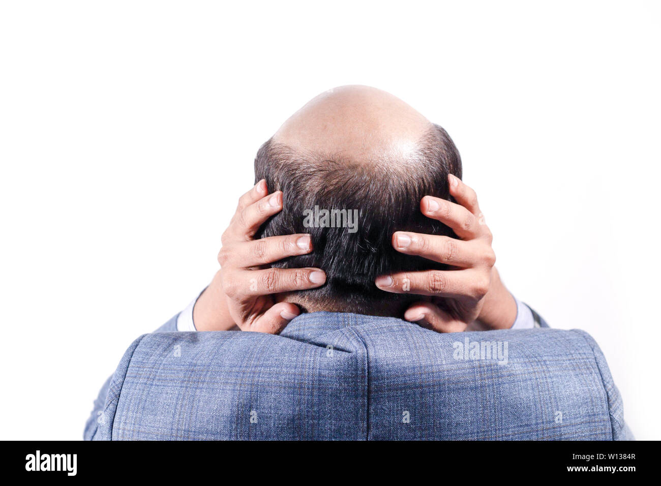 bald businessman with his head on scalp view from behind with white ...