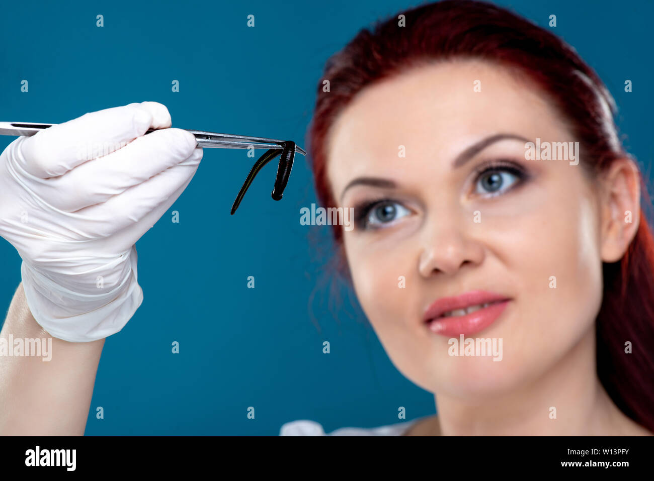 Woman doctor holds tweezers of medical leeches. Hirudotherapy, Hirudo ...