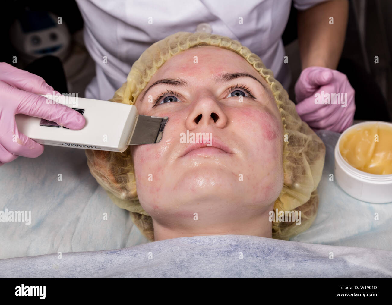 beautician at work. Ultrasonic face cleaning procedure for problem skin ...