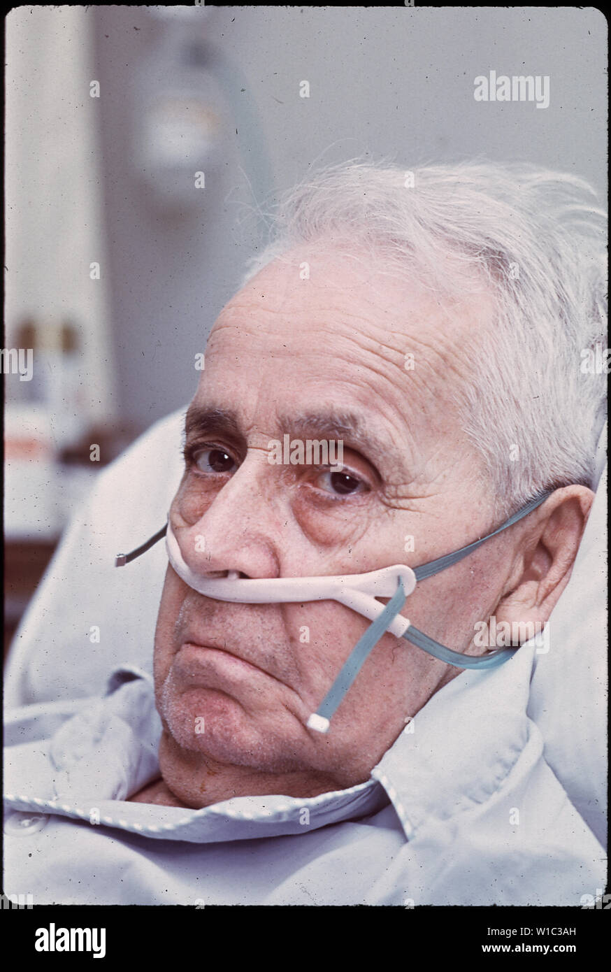 Patient with damaged lung hi-res stock photography and images - Alamy